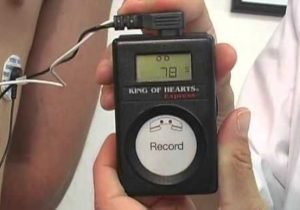 Loop ECG Monitoring - Mildura Cardio